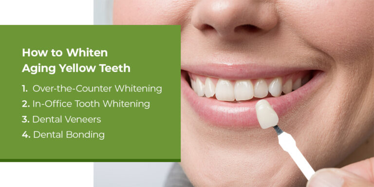 Why Do Teeth Turn Yellow With Age? | Drew Family Dentistry